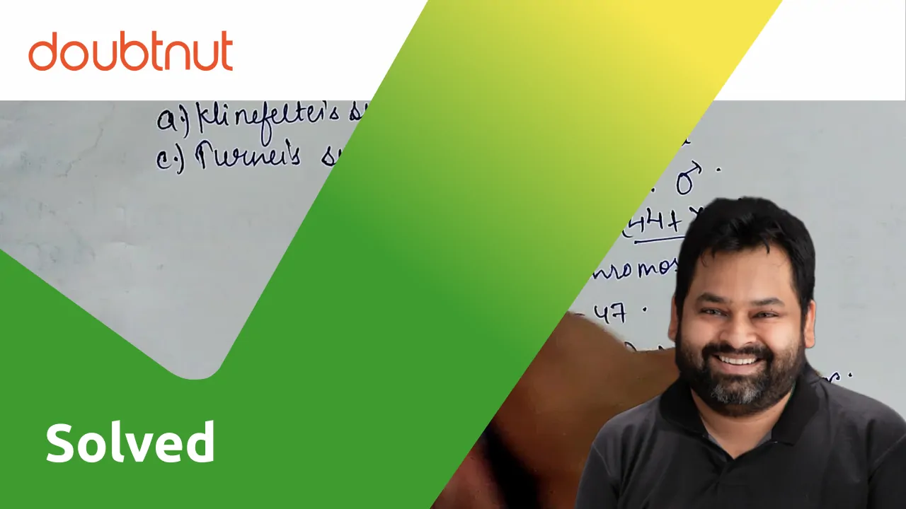 [44+" XXY condition is found in : "],[" Klinfelter's syndrome "],[" Do