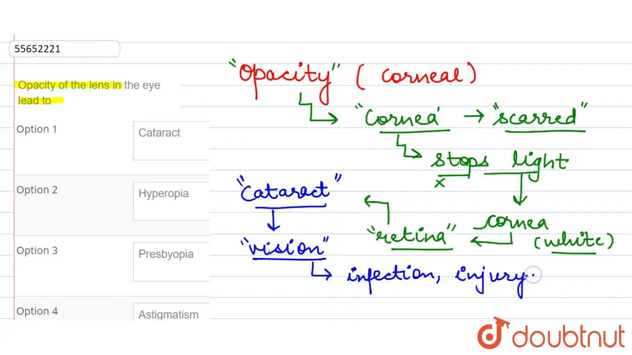 Opacity of the lens in the eye lead to