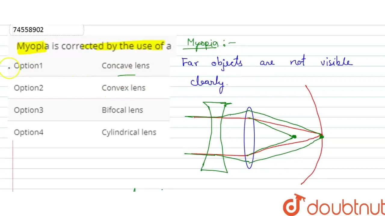 Myopia is corrected by the use of a