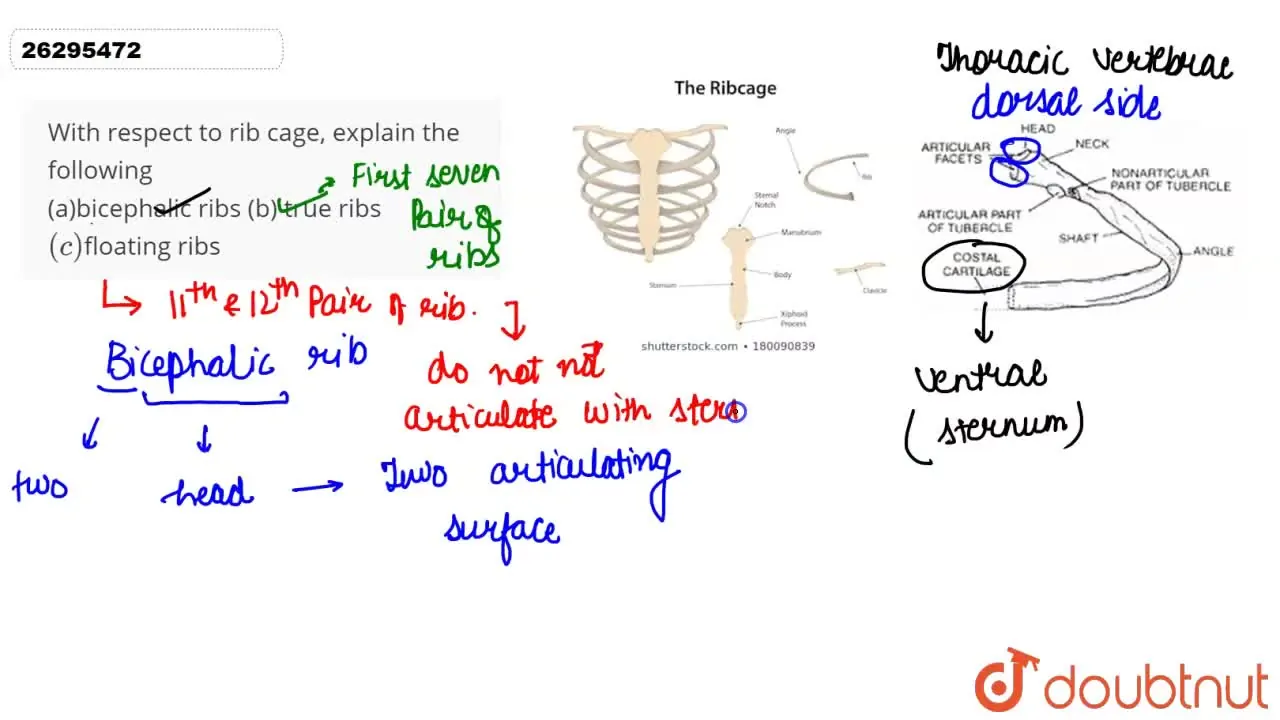 With respect to rib cage, explain the following (a)bicephalic ribs