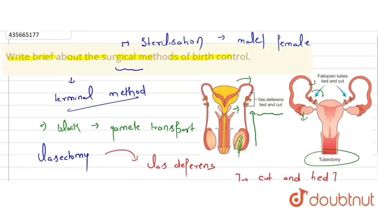 Write brief about the surgical methods of birth control.