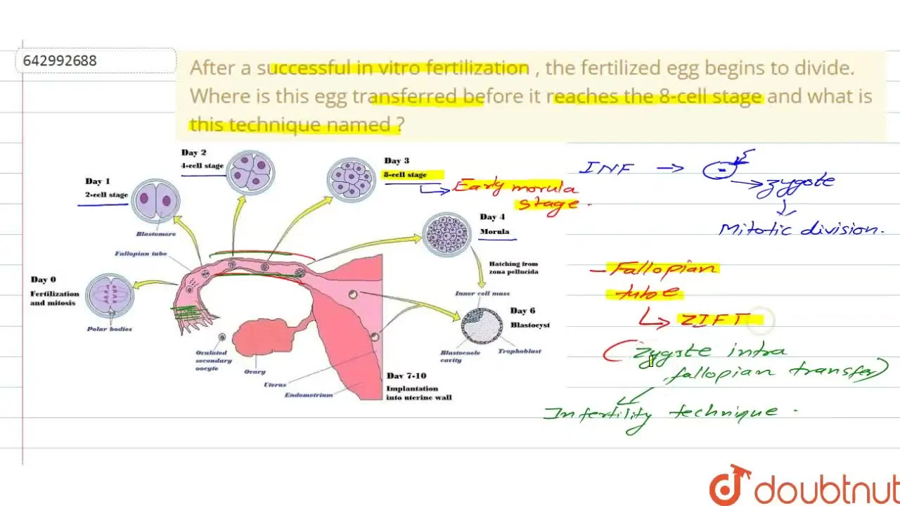 After a successful in vitro fertilization , the fertilized egg begins