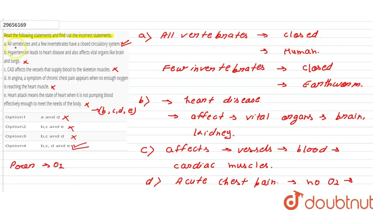 Read the following statements and find out the incorrect statements.