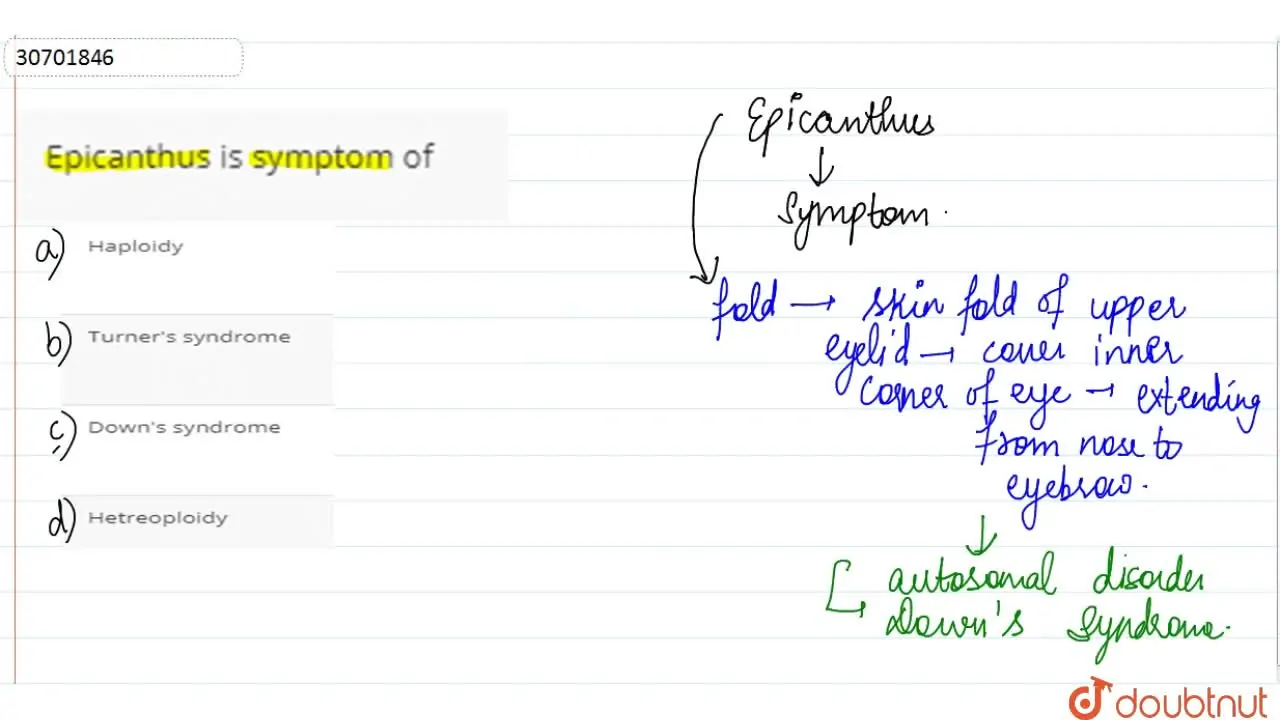 Epicanthus is symptom of