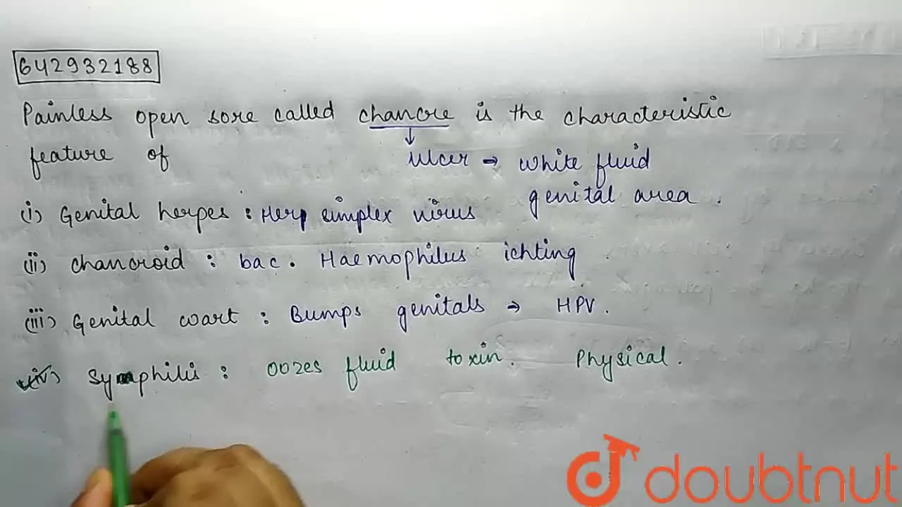 Painless open sore called chancre is the characteristic feature of