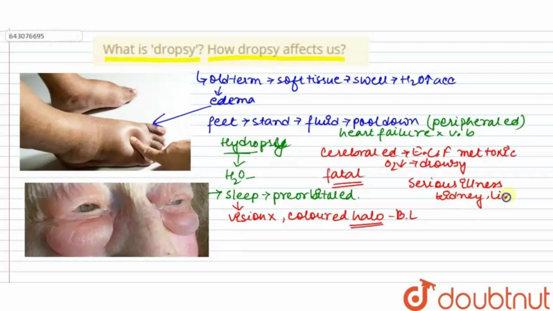 [Bengali Solution] What is 'dropsy'? How dropsy affects us?