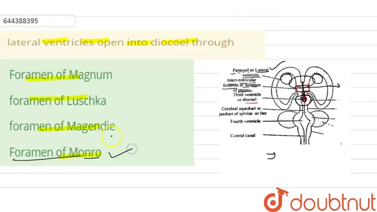 lateral ventricles open into diocoel through
