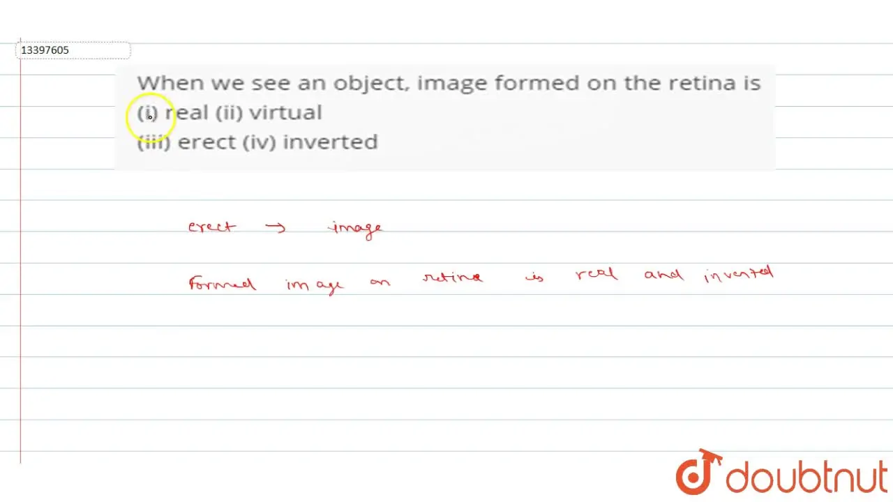 When we see an object, image formed on the retina is (i) real (ii) v